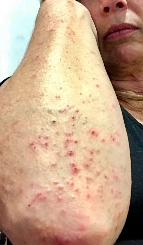 Delta Flight Attendant: “Lands’ End Uniform is Toxic, Making me Sick ...